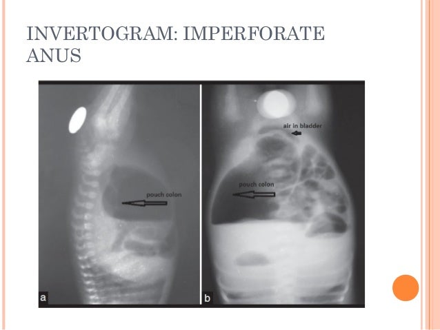 Gi radiology mbbs final