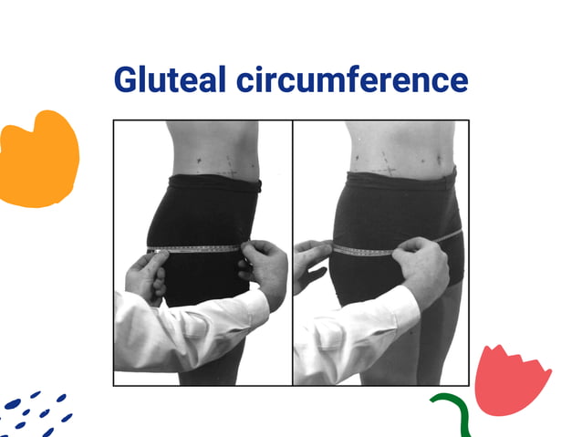 Girth measurement By Dr. Sachi mevada (Masters in Physiotherapy of ...