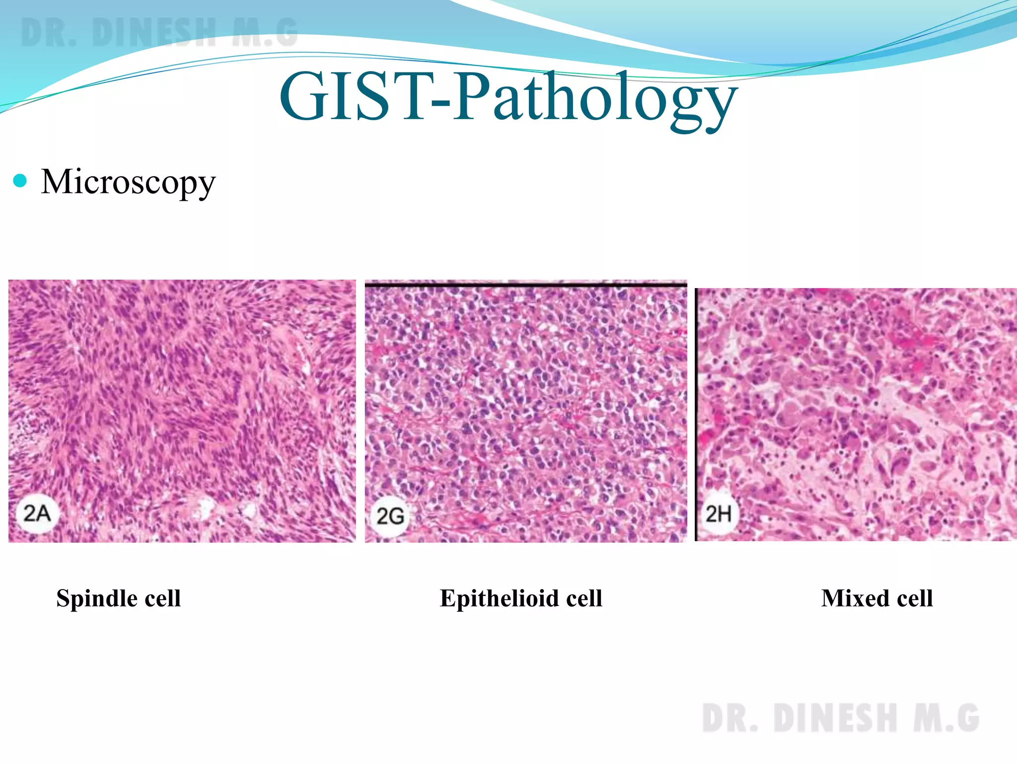 GIST | PPTX