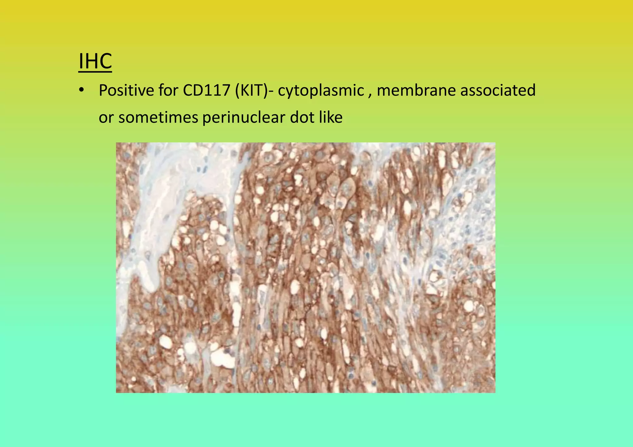 Gastro intestinal stromal tumor(GIST)-PATHOLOGY | PPTX