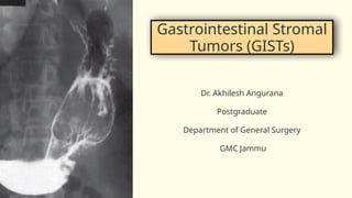 Gastrointestinal Stromal Tumors (GIST): Diagnosis, Molecular Pathology ...