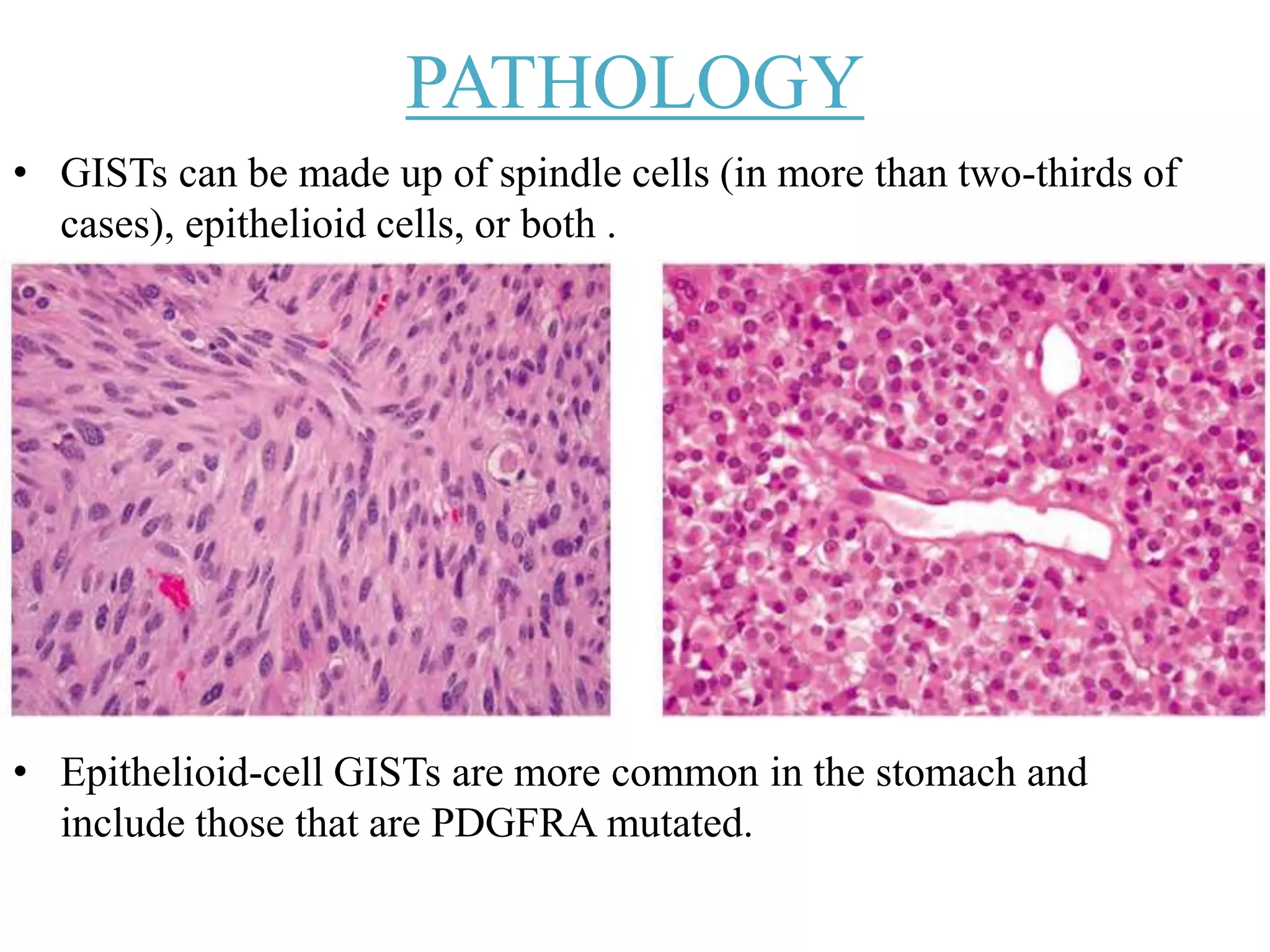 Gist | PPT