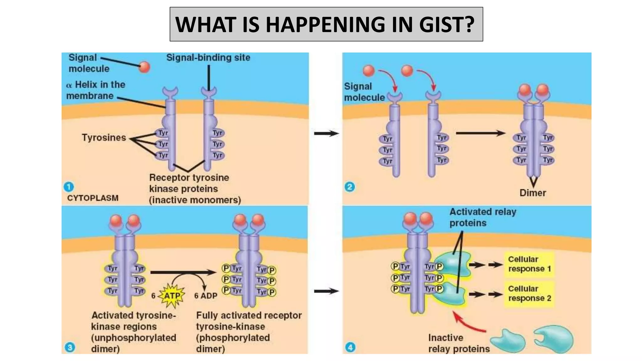 Gastrointestinal stromal tumors (GIST).pptx