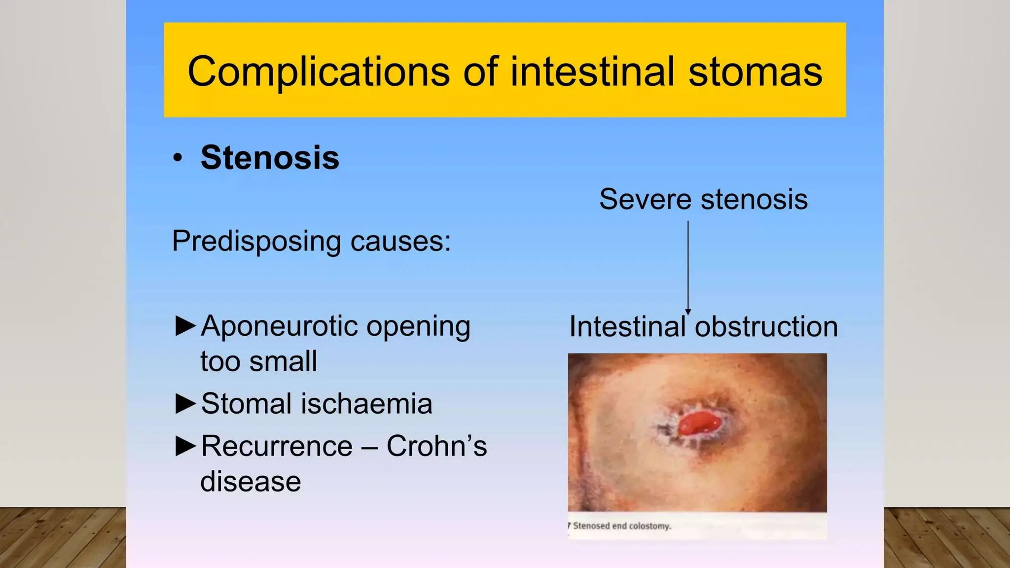 Gastrointestinal stoma.pptx. by doctor silungwe | PPT