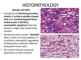 Gastrointestinal Stromal Tumors. | PPTX
