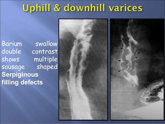 GIT Imaging for Medical Students