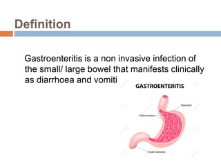 GASTROENTERITIS | PPTX