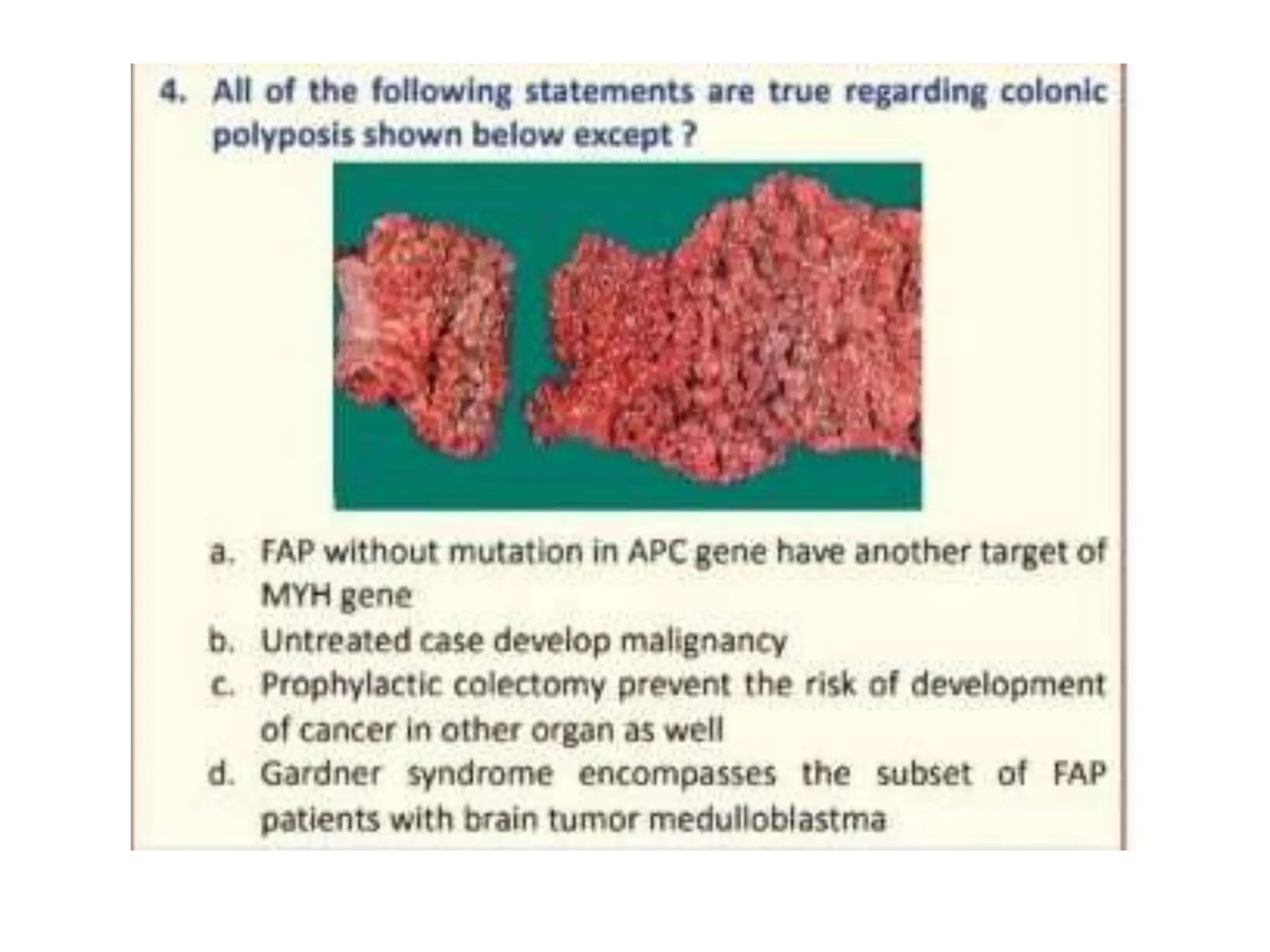 Gastrointestinal system ppt GERD Barrett's esophagus Carcinoma ...