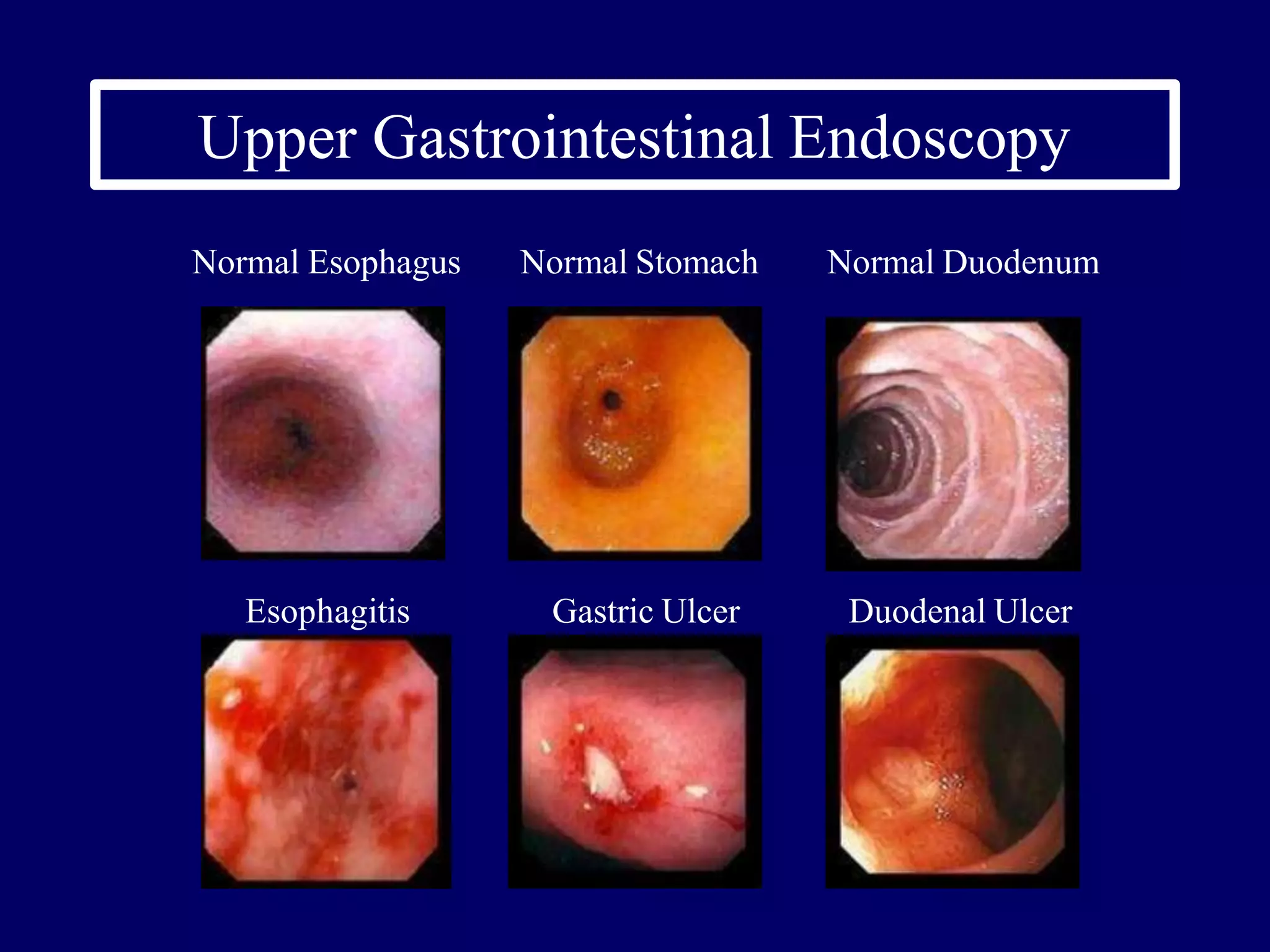 Gastro intestinal system diagnostic-tests- | PPTX