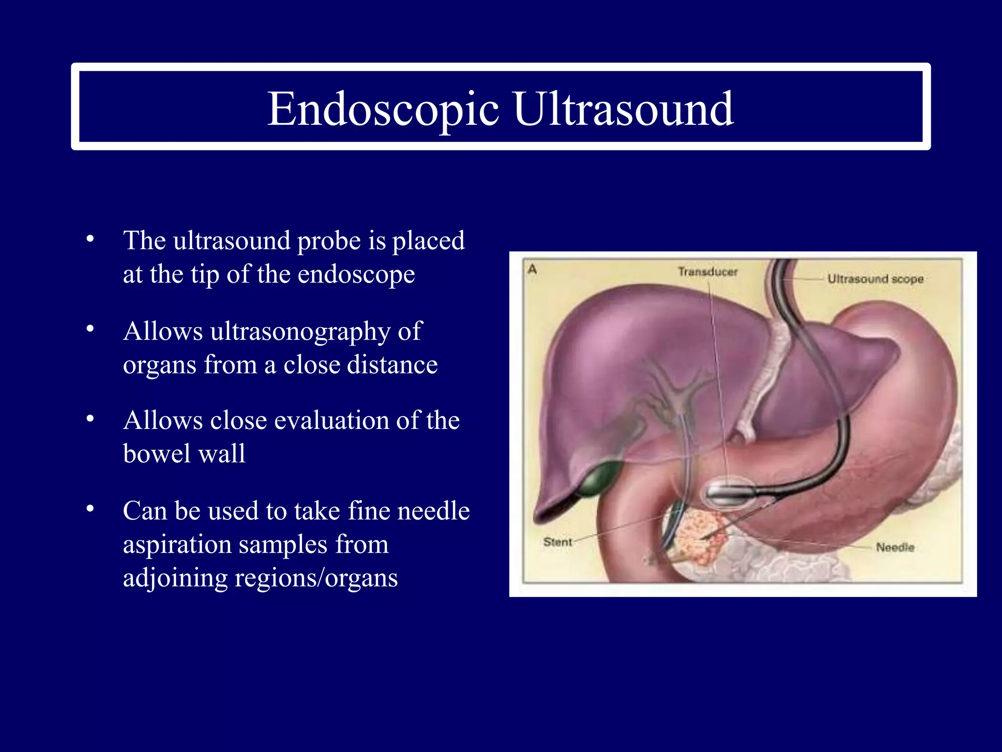 Gastro intestinal system diagnostic-tests- | PPTX