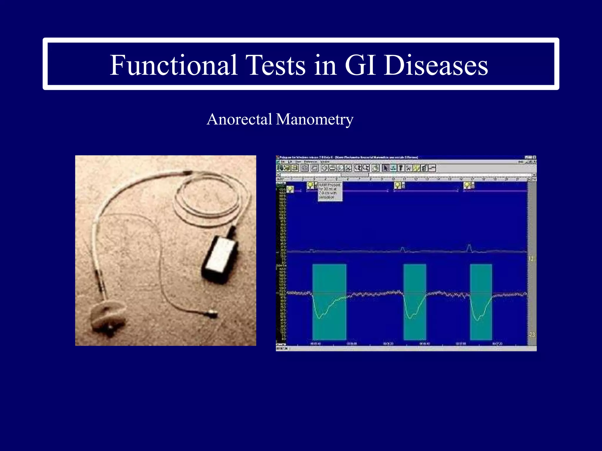 Gastro intestinal system diagnostic-tests- | PPTX