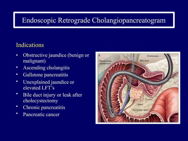 Gastro intestinal system diagnostic-tests- | PPTX