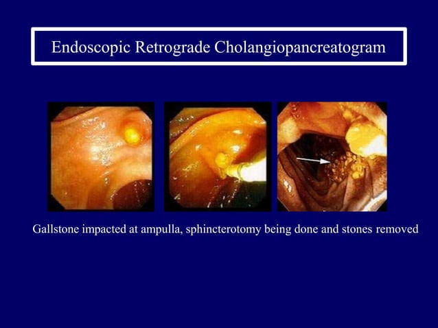 Gastro intestinal system diagnostic-tests- | PPTX