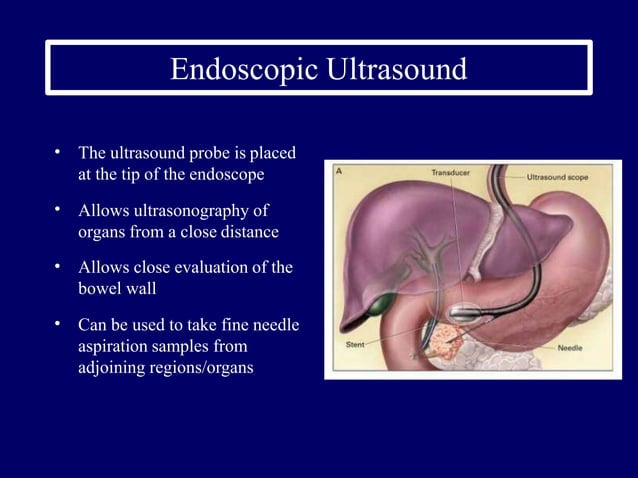 Gastro intestinal system diagnostic-tests- | PPTX