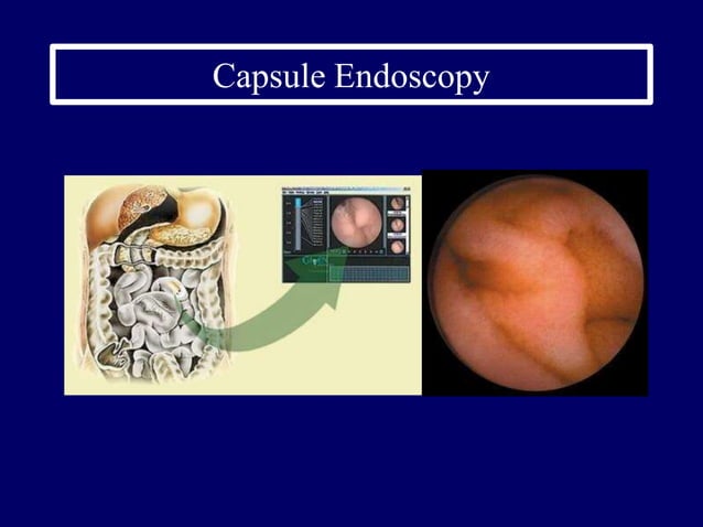 Gastro intestinal system diagnostic-tests- | PPTX