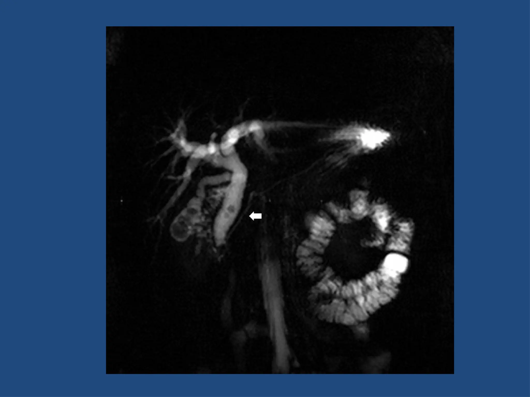 git-radiology- introduction to medical students.pptx