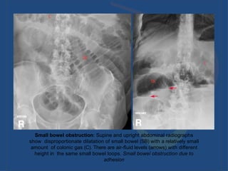 git-radiology- introduction to medical students.pptx