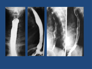 git-radiology- introduction to medical students.pptx