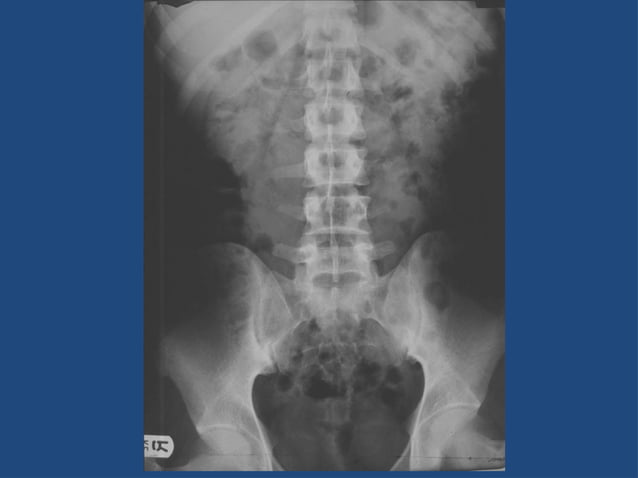 git-radiology- introduction to medical students.pptx | Digestive Disorders | Diseases and Conditions