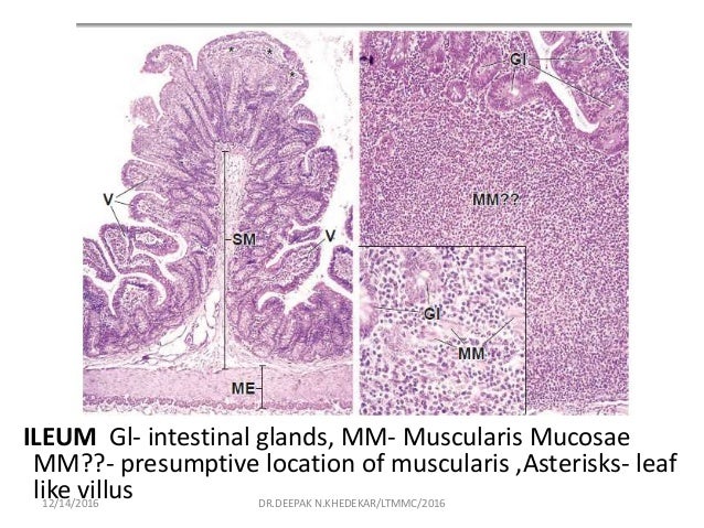 A Histology Tour Of The Gi Tract The Ileum