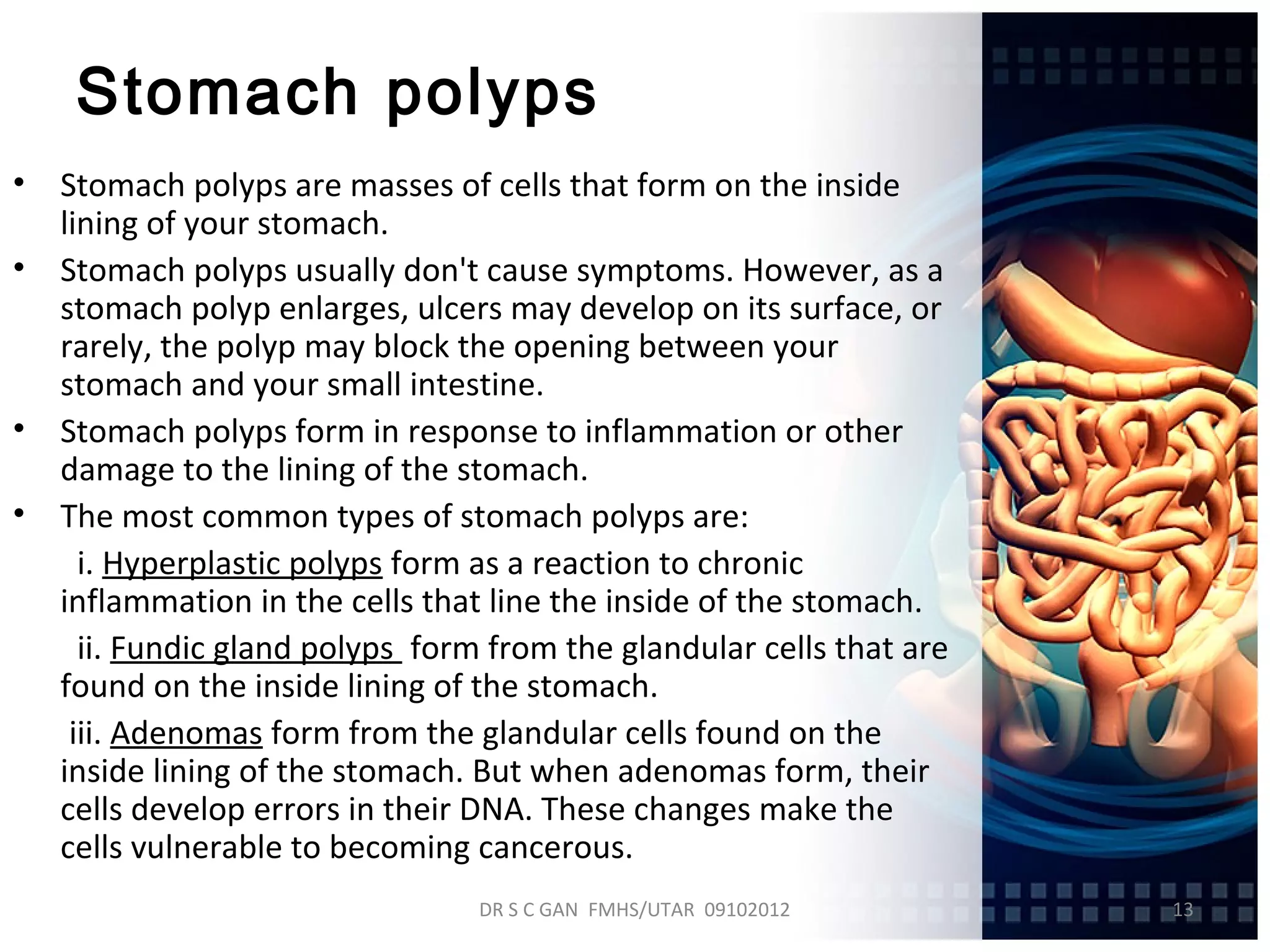 Git4 inflammatory bowel diseases | PPT