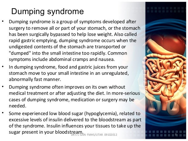 Dumping Syndrome Diet Fiber Pills - cocoposts