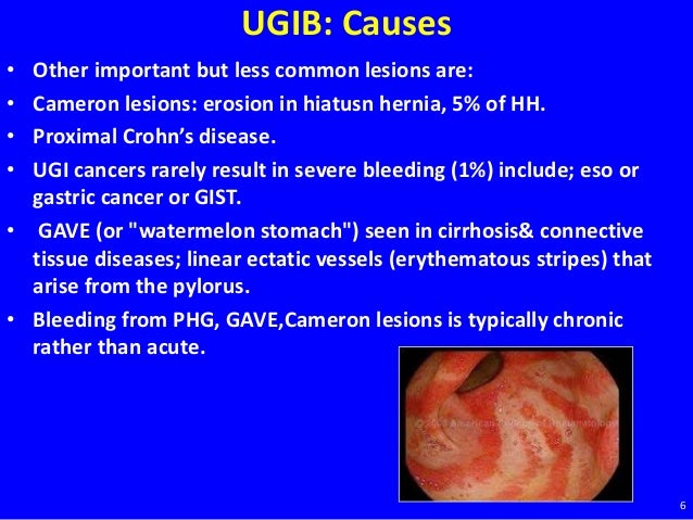 GIT Bleeding for 4th year.