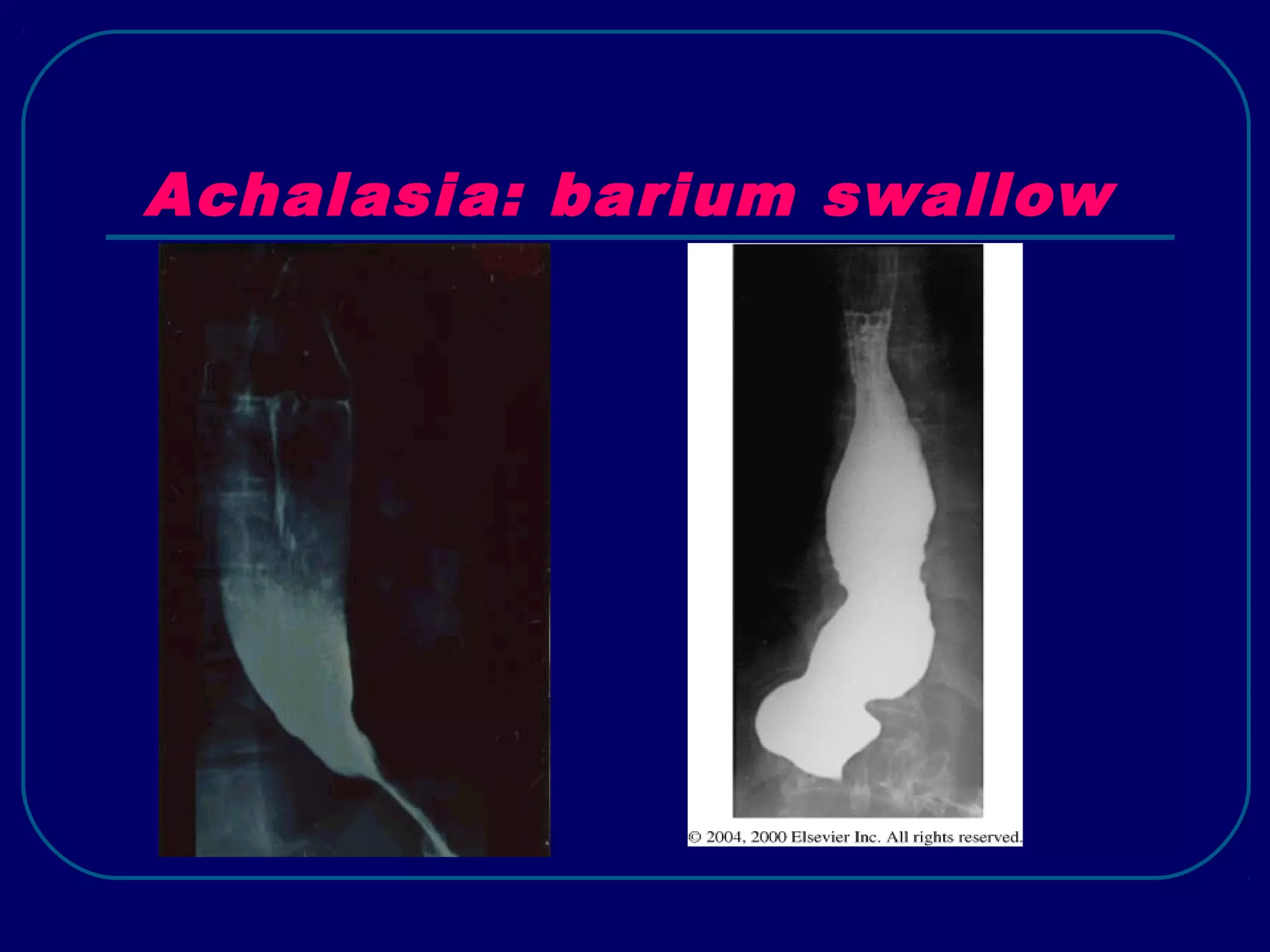 GIT 4th motility 2016. | PPT