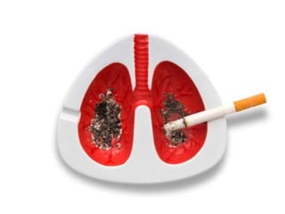 LUNG CANCER MANAGEMENT IN LOW RESOURCE SETTINGS | PPTX