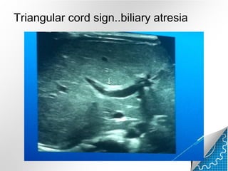 Git and hepatobiliary radiology mocks fcps | PPT