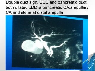 Git and hepatobiliary radiology mocks fcps | PPT