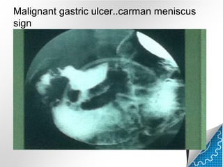 Git and hepatobiliary radiology mocks fcps | PPT