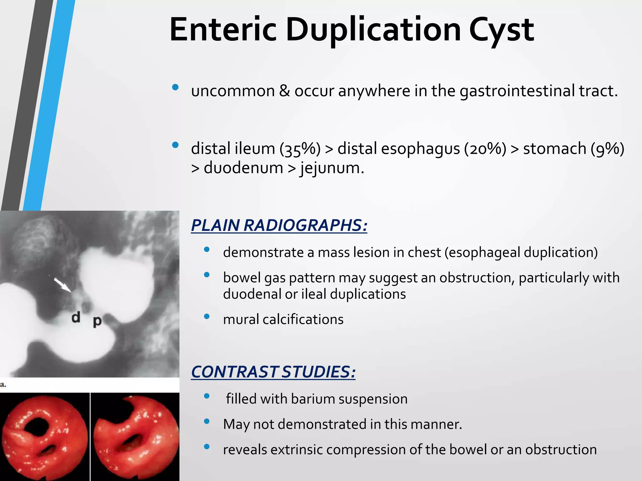 Git anomalies | PPTX