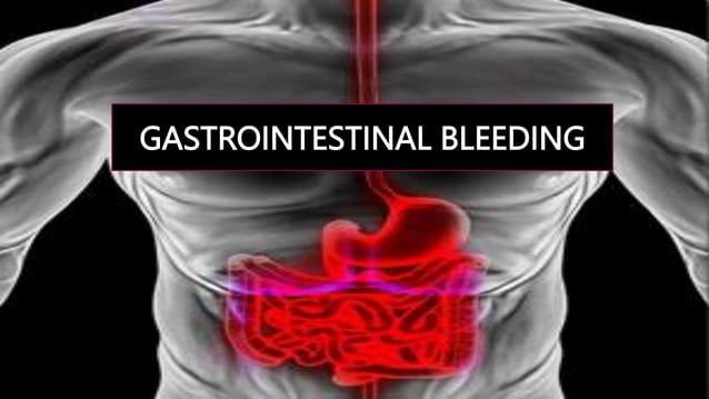 Git bleeding.pptx all detail, causes, symptoms | PPTX | Digestive Disorders | Diseases and ...