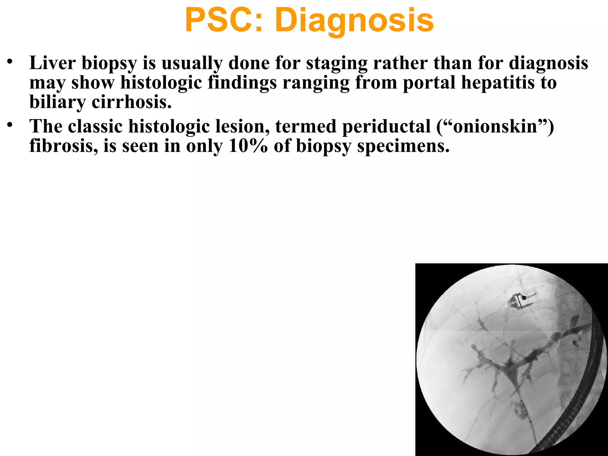 GIT Autoimmune cholestatic liver diseases. | PPT