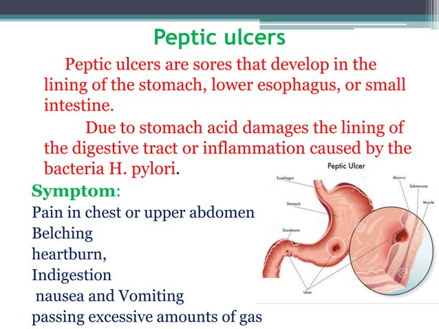 GIT disorder | PPTX | Digestive Disorders | Diseases and Conditions