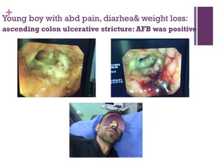 Git endo pictures from our center practice | PDF | Digestive Disorders ...