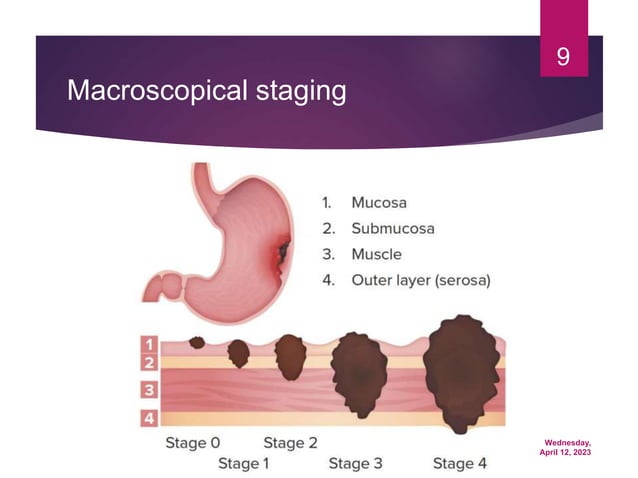 Gastrointestinal Tract Endoscopic Biopsies Ppt