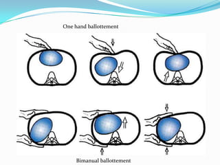 Git examination pediatrics awais | PPTX
