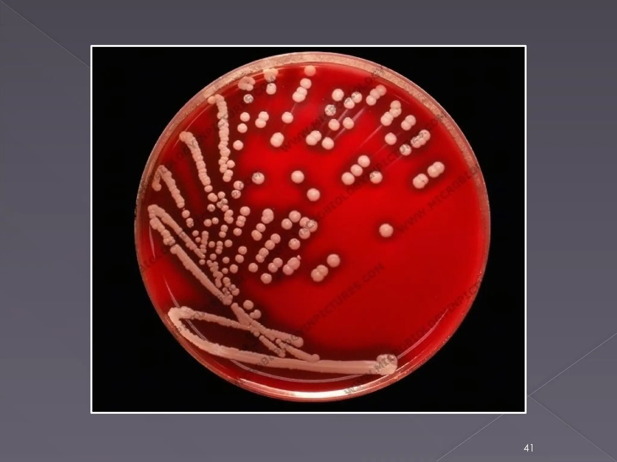 نسخة من GIT infections microbiology (1)-2017.pptx
