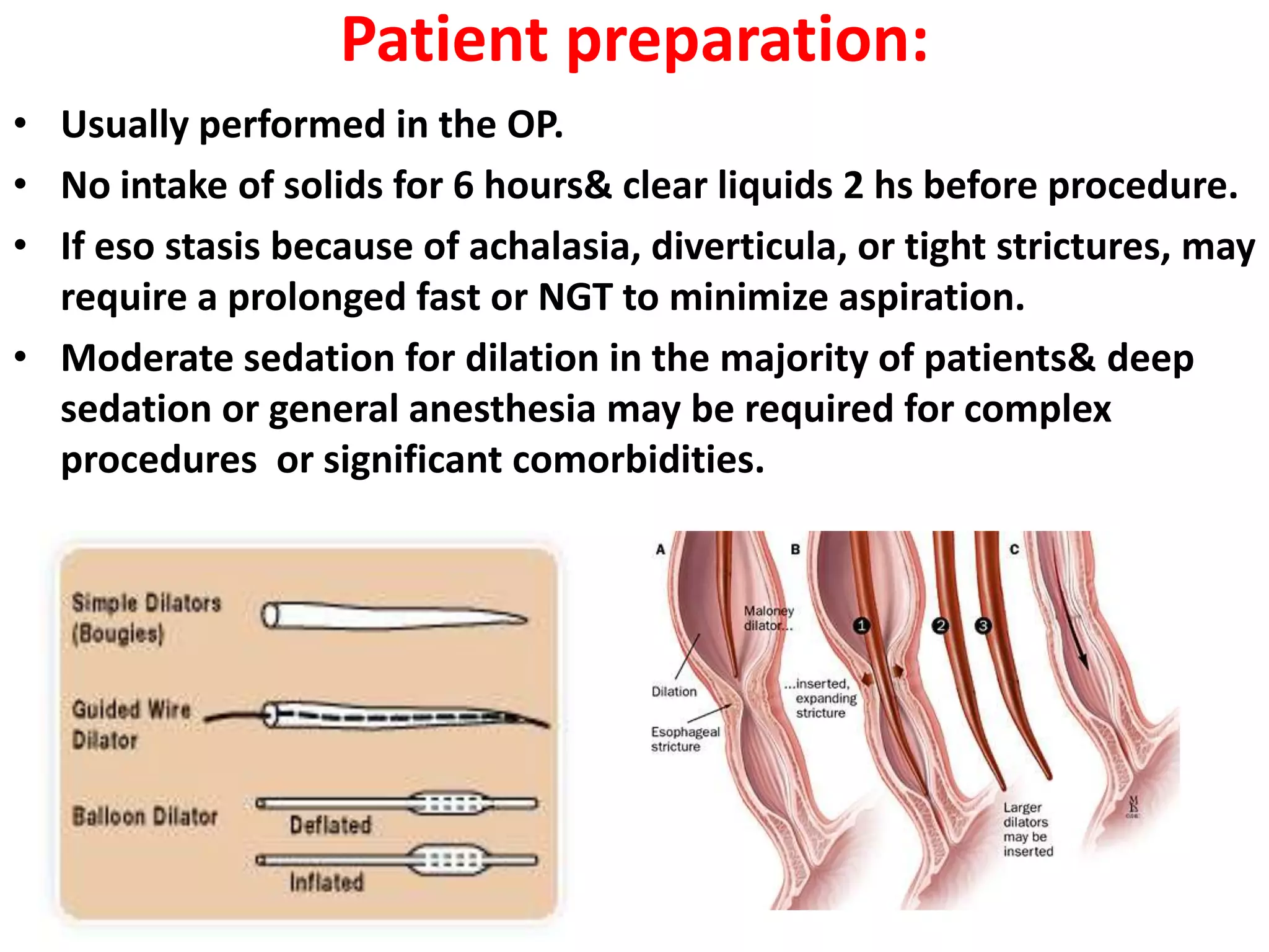 Git j club dysphagia endoscopy. | PPTX