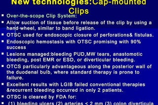 GIT j club endohemostasis new | PPT