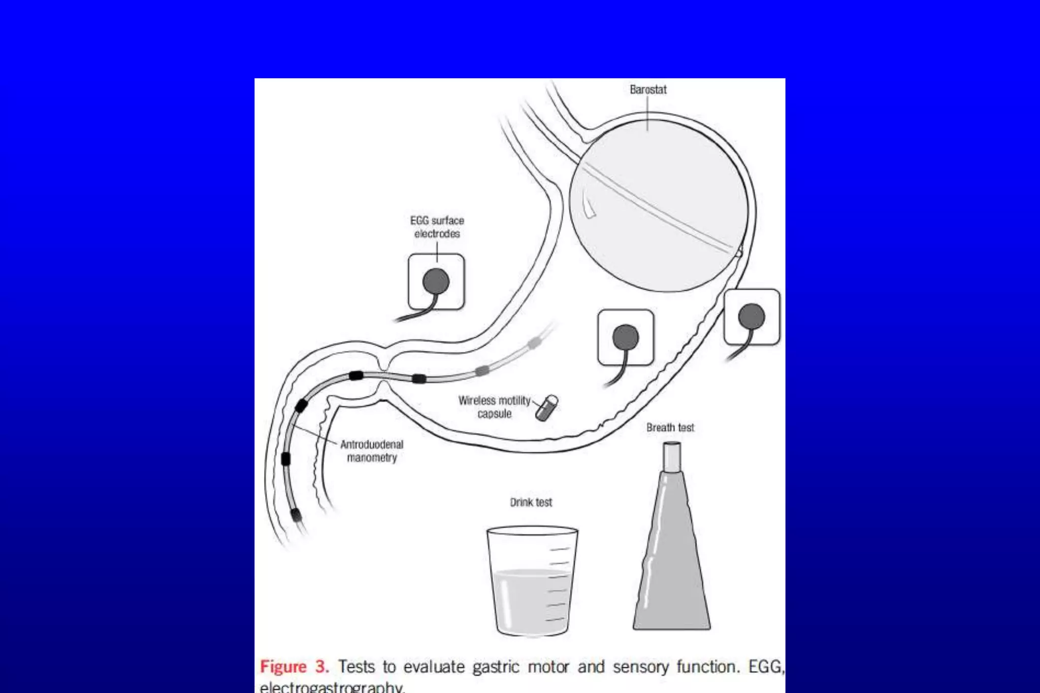 Git j club gastric motor sensory disorders21 | PPTX