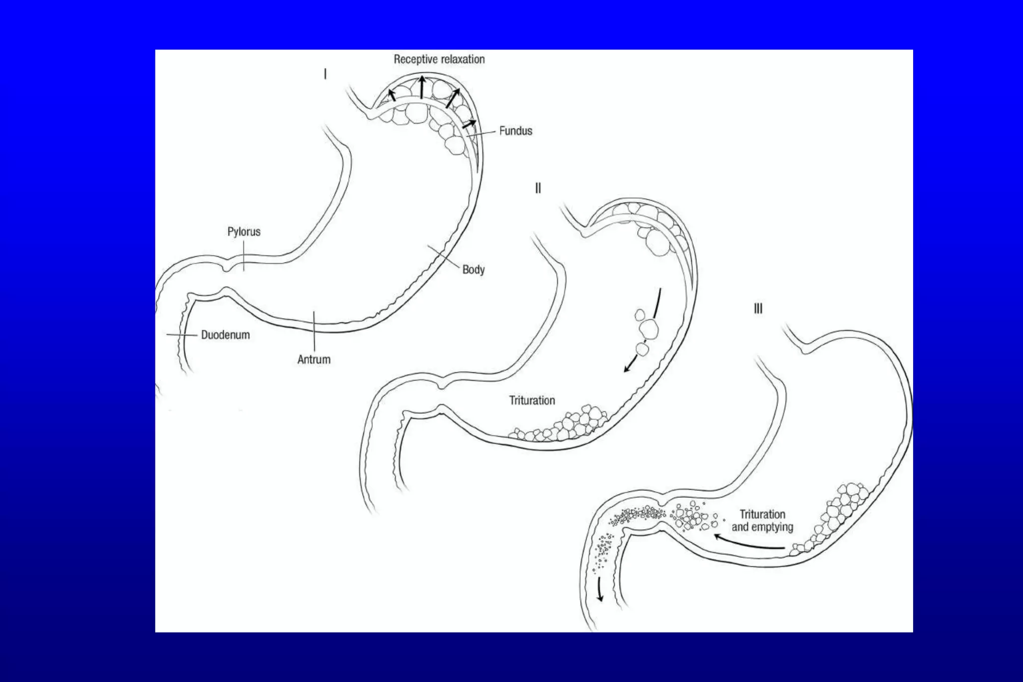 Git j club gastric motor sensory disorders21 | PPTX
