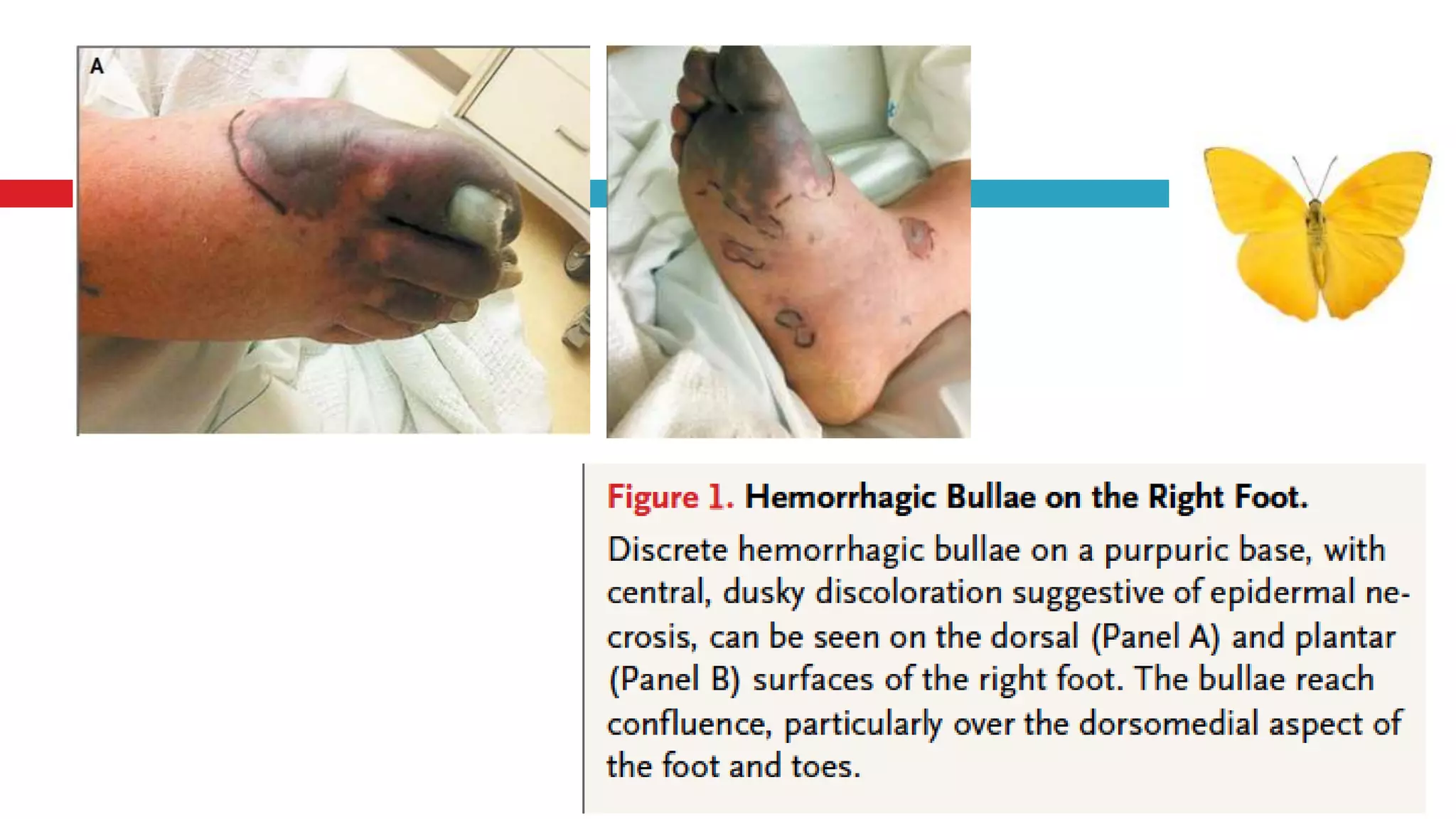 Git j club nejm case pad. | PPT