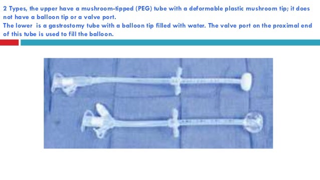 Git j club nejm gt change.