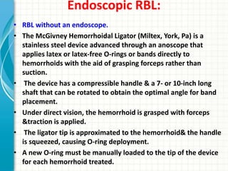 Git j club office based pile treatments. | PPT