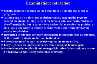 Git j club stoma complains21 | PPT