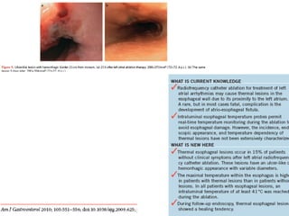 Git Journals Scan | PPT