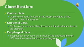 GIT LECTURE 4 Peptic ulcer.pptx